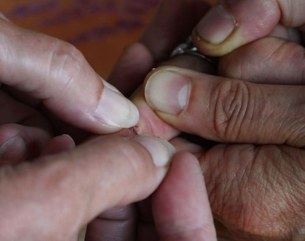 Como tirar cola super bonder do dedo: conheça 3 métodos simples e ...